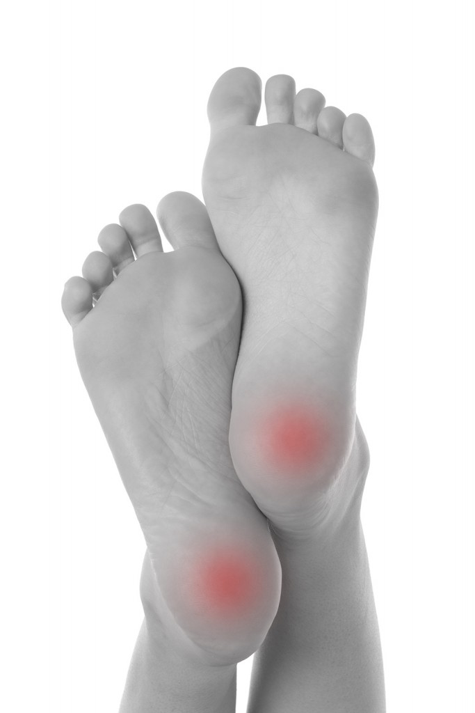 L'aponévrose plantaire - Pied et Cheville