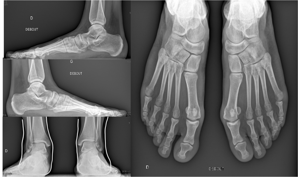 Quel bilan radio? - Pied et Cheville